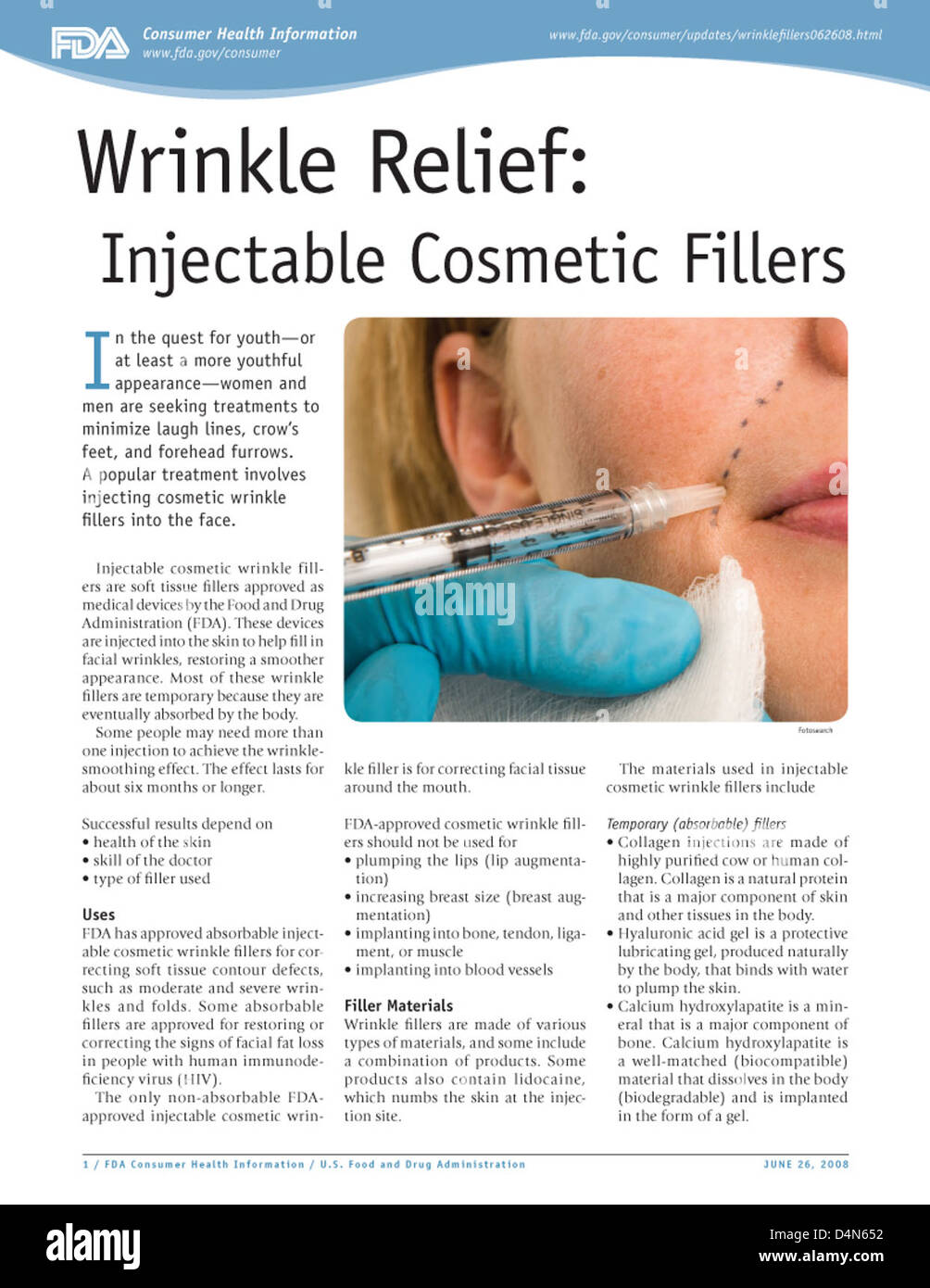 Botox Cosmetic and other injectable wrinkle fillers, such as PLLA and ...