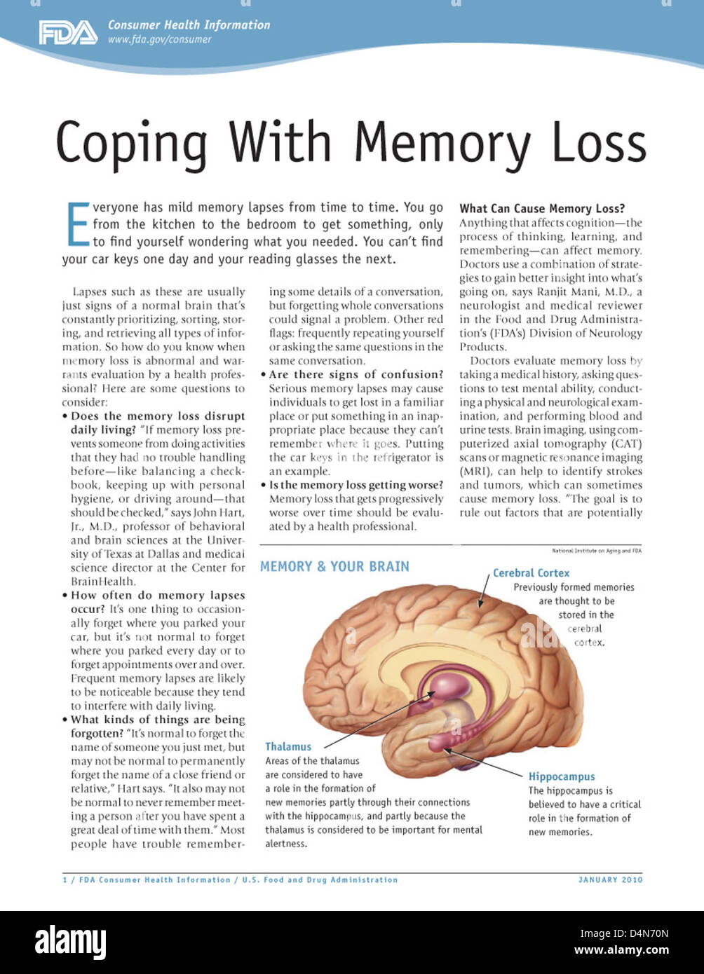Memory loss associated with Alzheimer's disease can be managed with ...