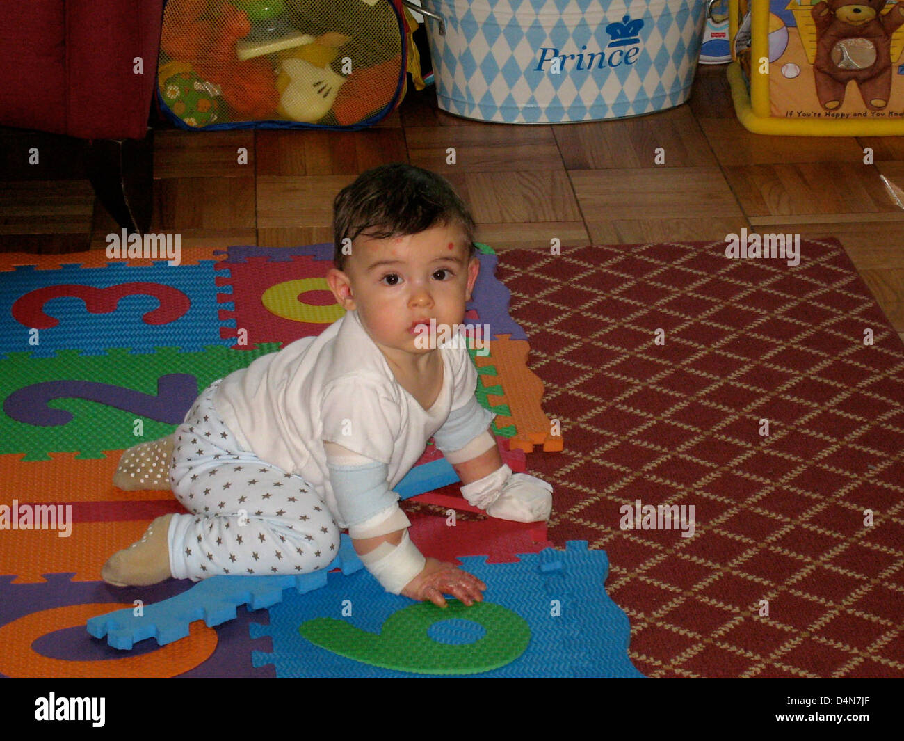 Dystrophic Epidermolysis Bullosa (DEB) is a rare genetic condition ...