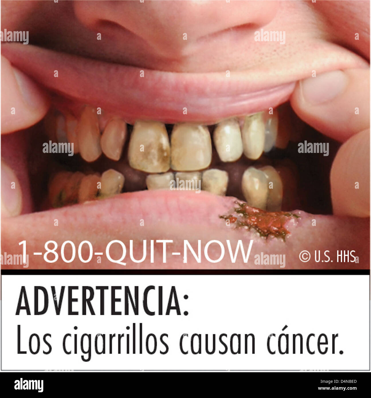 Cigarette Health Warning Images - (En Español Stock Photo - Alamy