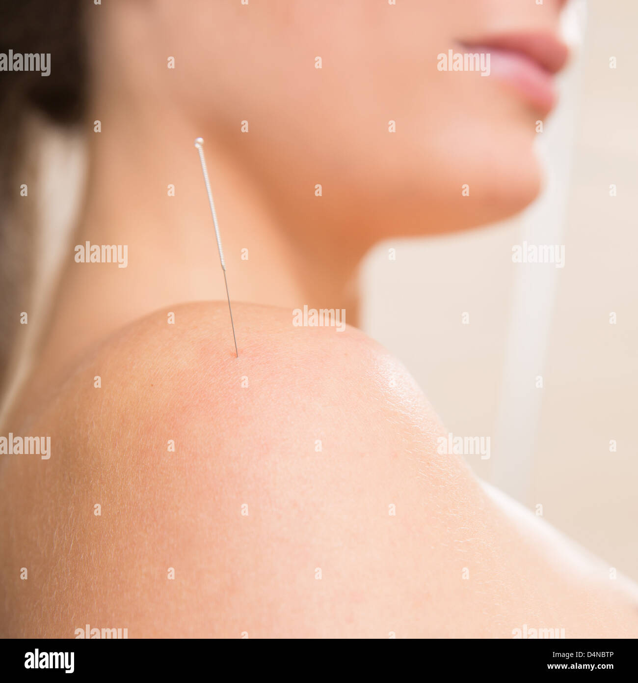Shoulder therapy hi-res stock photography and images - Alamy