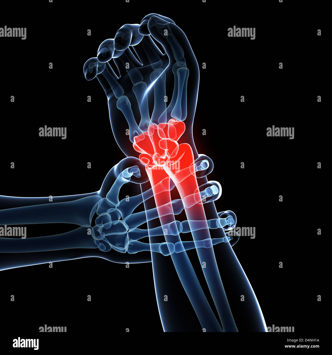 Arm wrist hand hi-res stock photography and images - Alamy