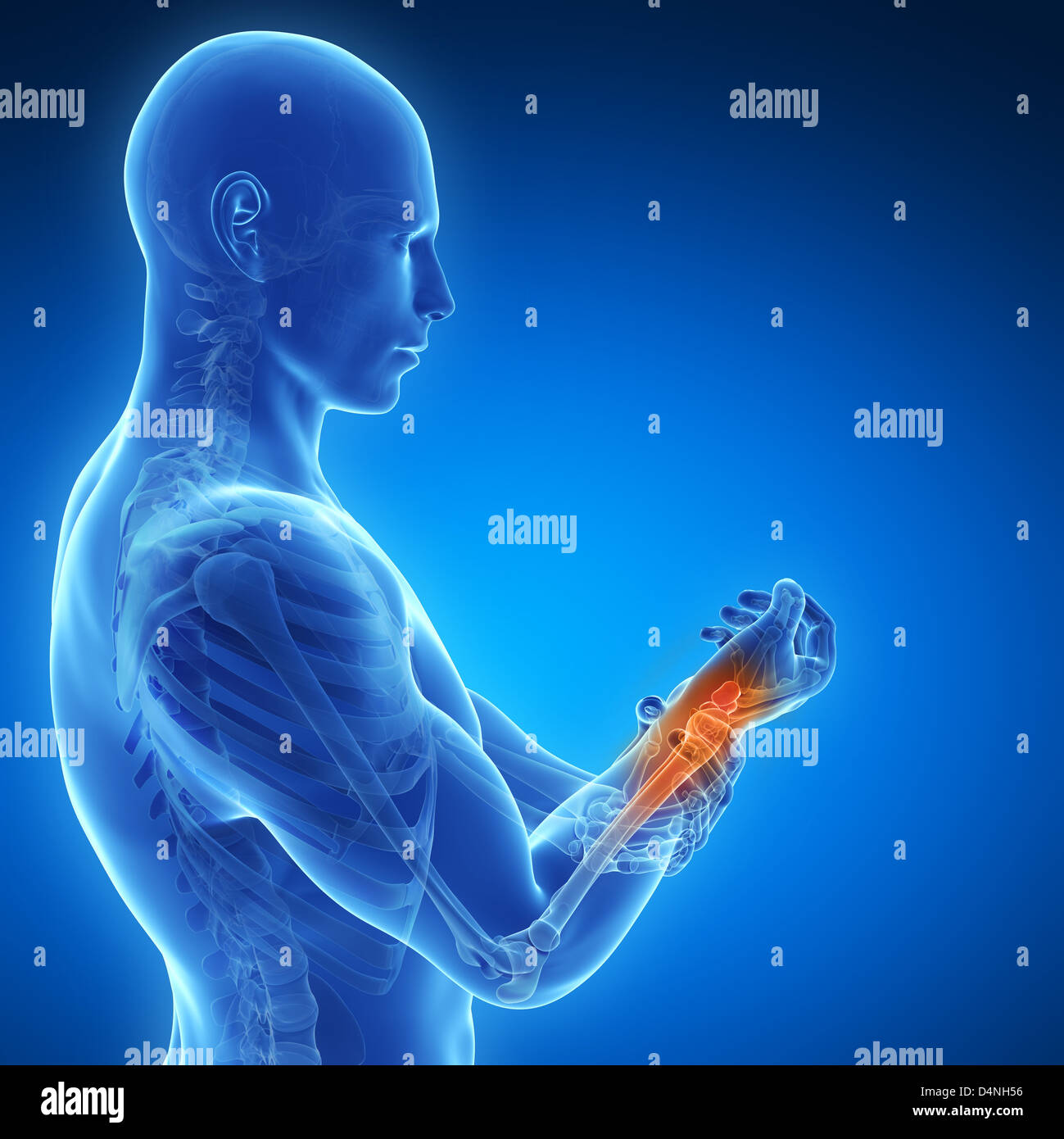 Wrist joint hi-res stock photography and images - Alamy