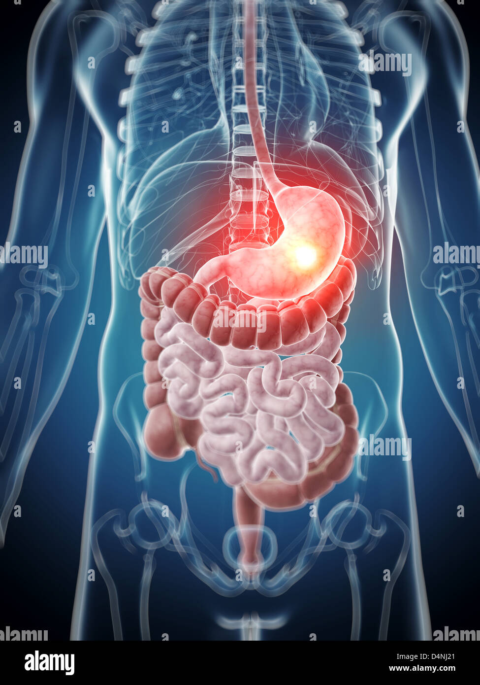 Stomache ache hi-res stock photography and images - Alamy