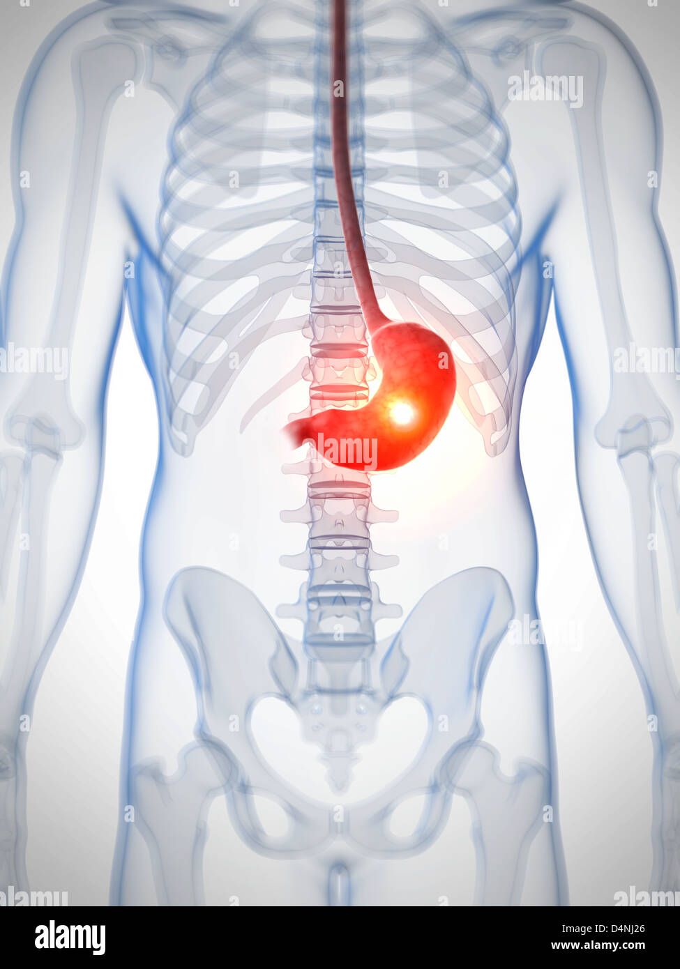 Stomache ache hi-res stock photography and images - Alamy