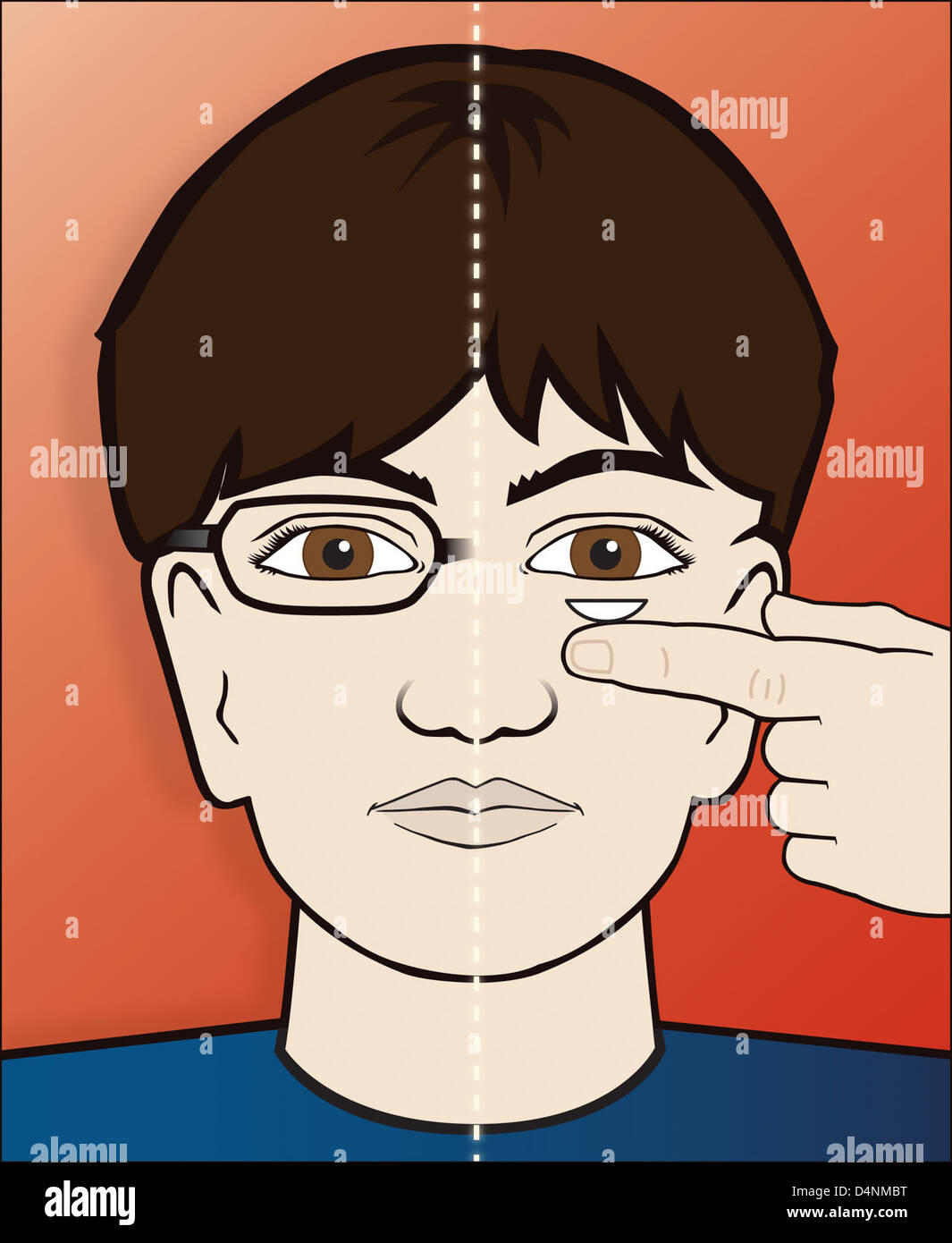 Proper care and safety practices for children using contact lenses are ...