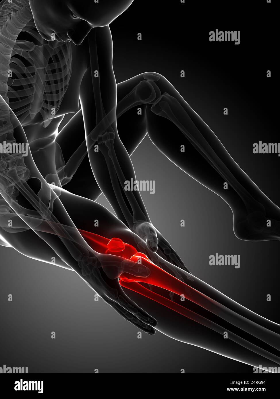 Femur bone illustration highlighted hi-res stock photography and images ...