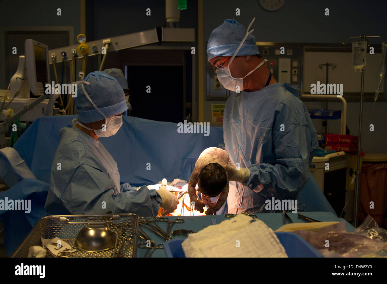 Cesarean in a hospital.a newborn in operating room Stock Photo - Alamy
