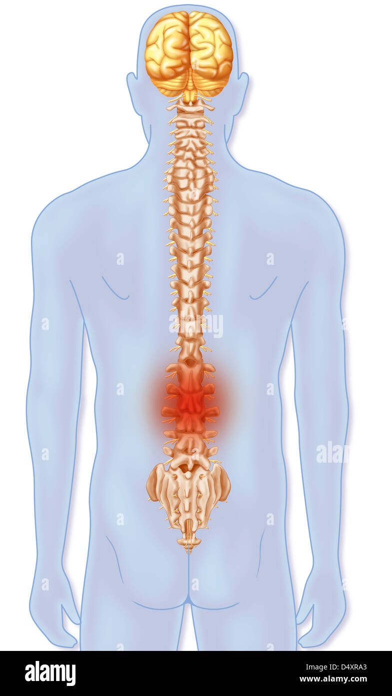 Lower back pain illustration hi-res stock photography and images - Alamy