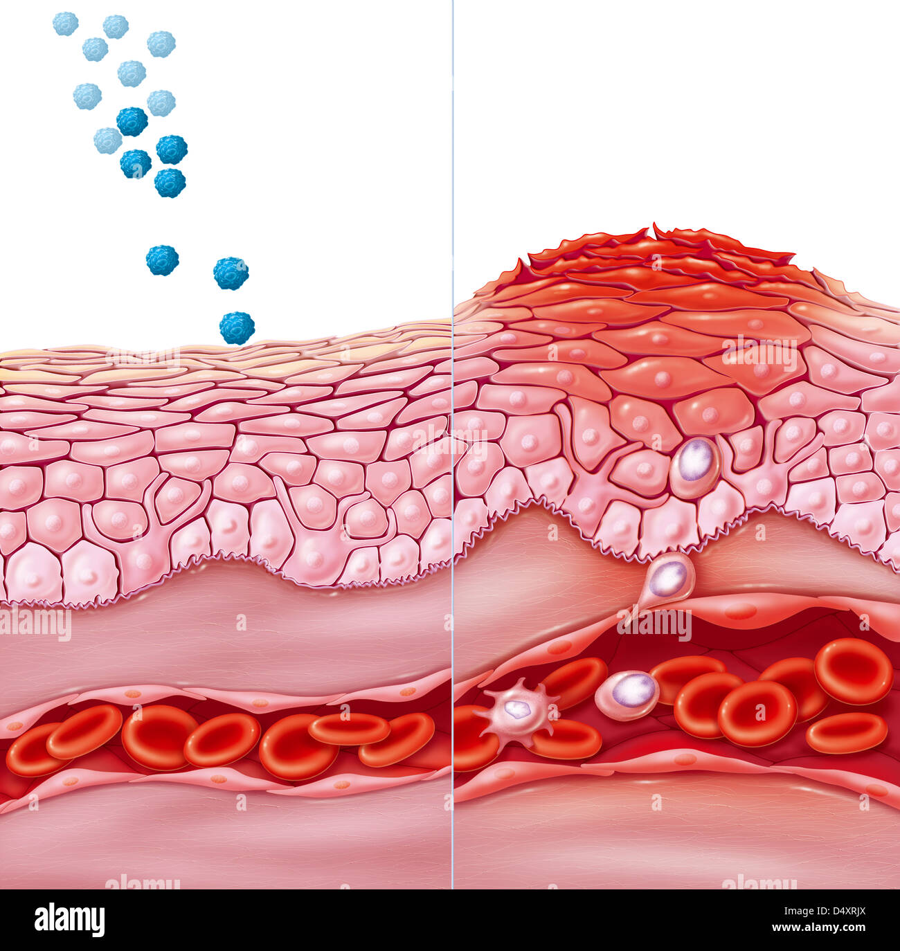 Human skin cells pathology hi-res stock photography and images - Alamy