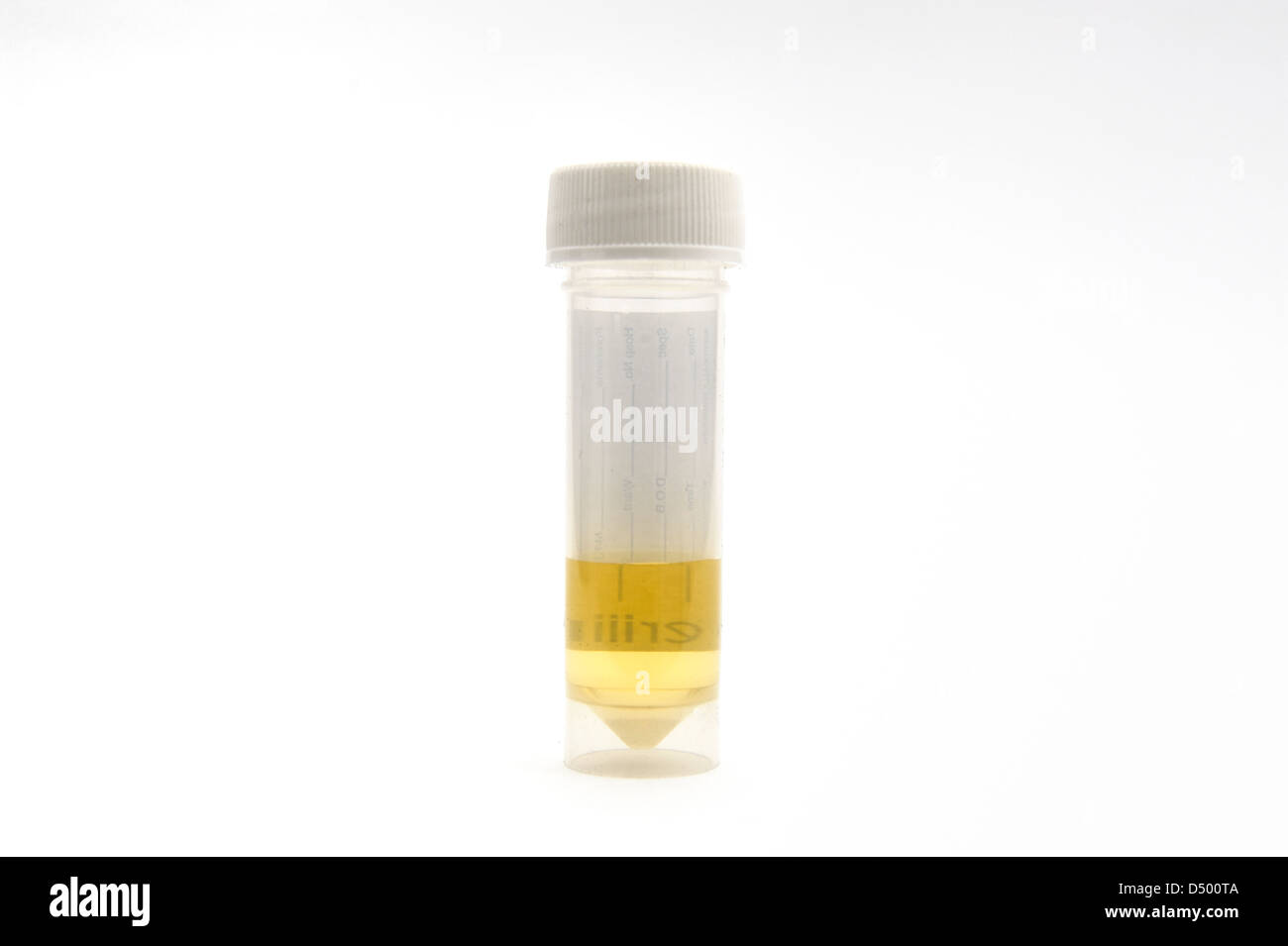 urine test sample bottle Stock Photo - Alamy