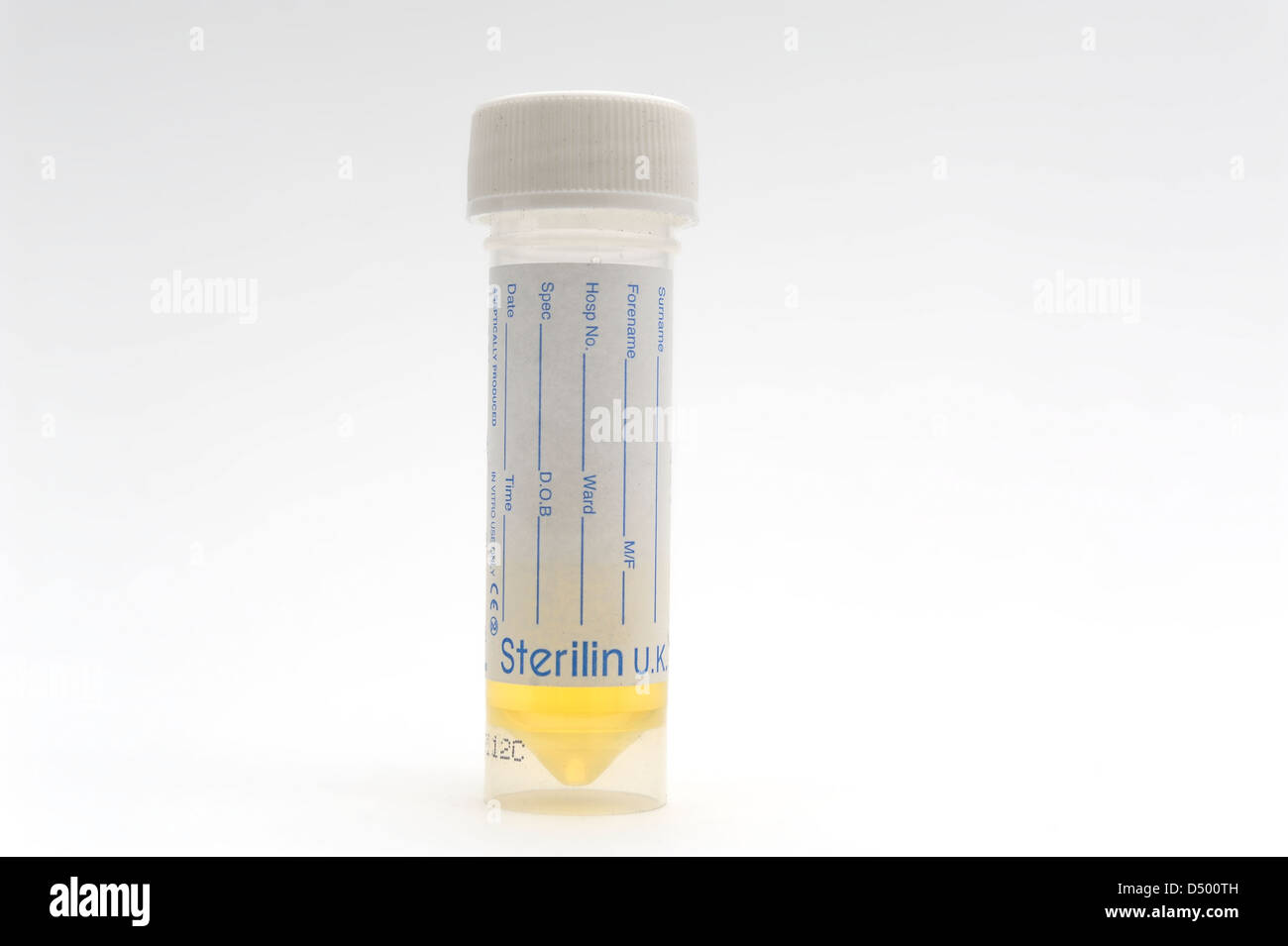 urine test sample bottle Stock Photo - Alamy