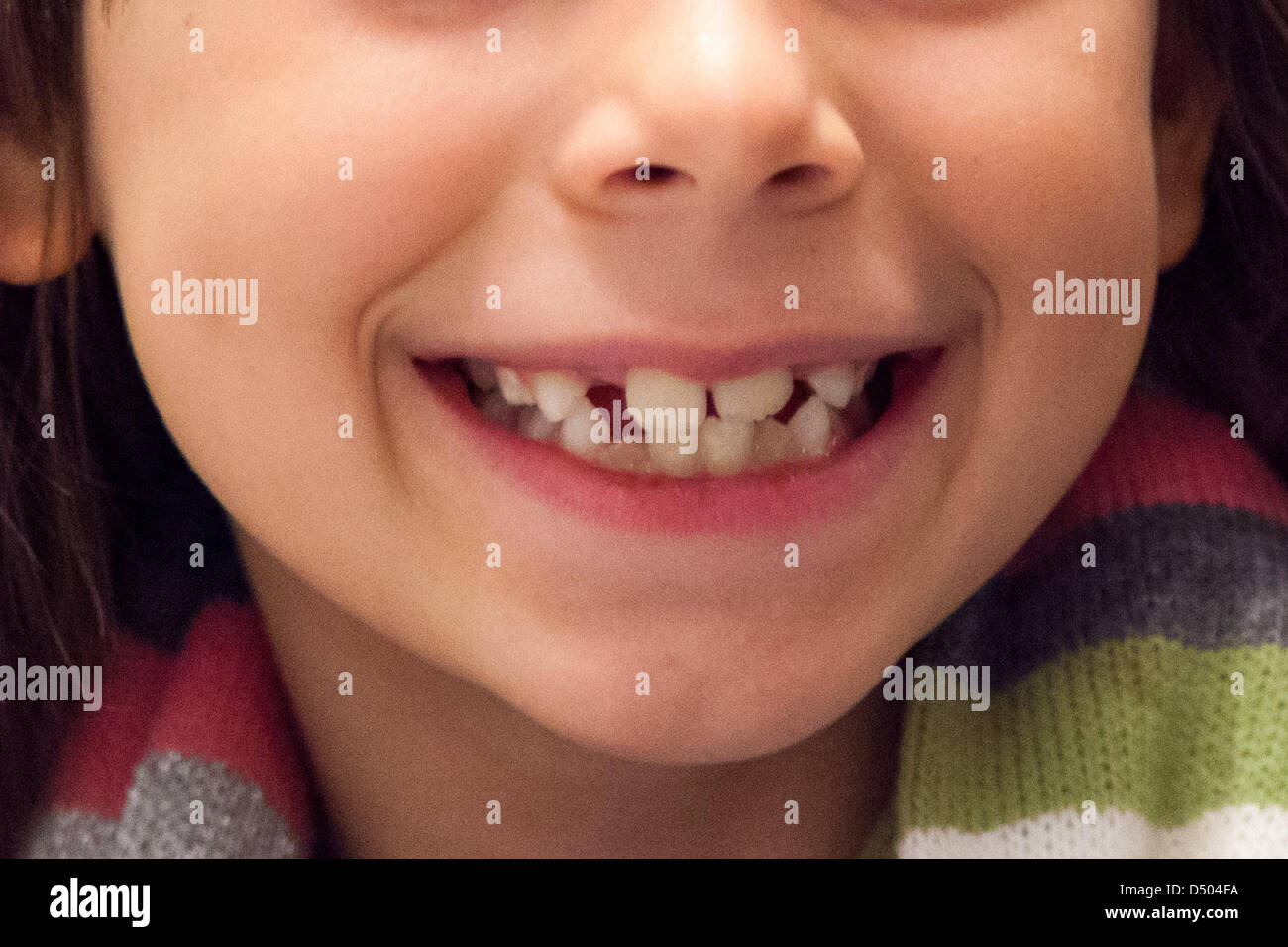 A girl of eight smiles and proudly shows her first and second teeth ...