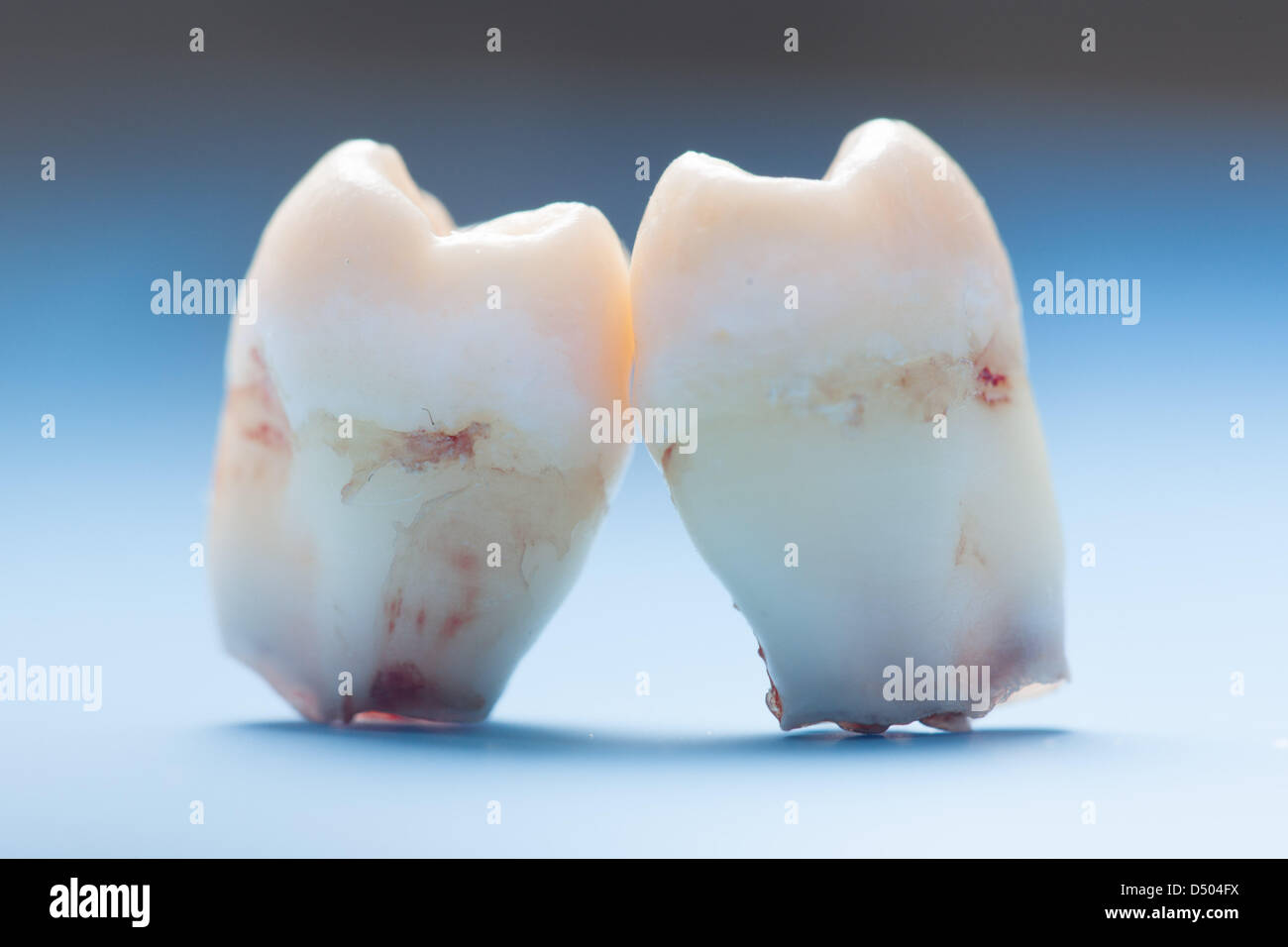 Clean extracted wisdom teeth, not fully developed Stock Photo - Alamy