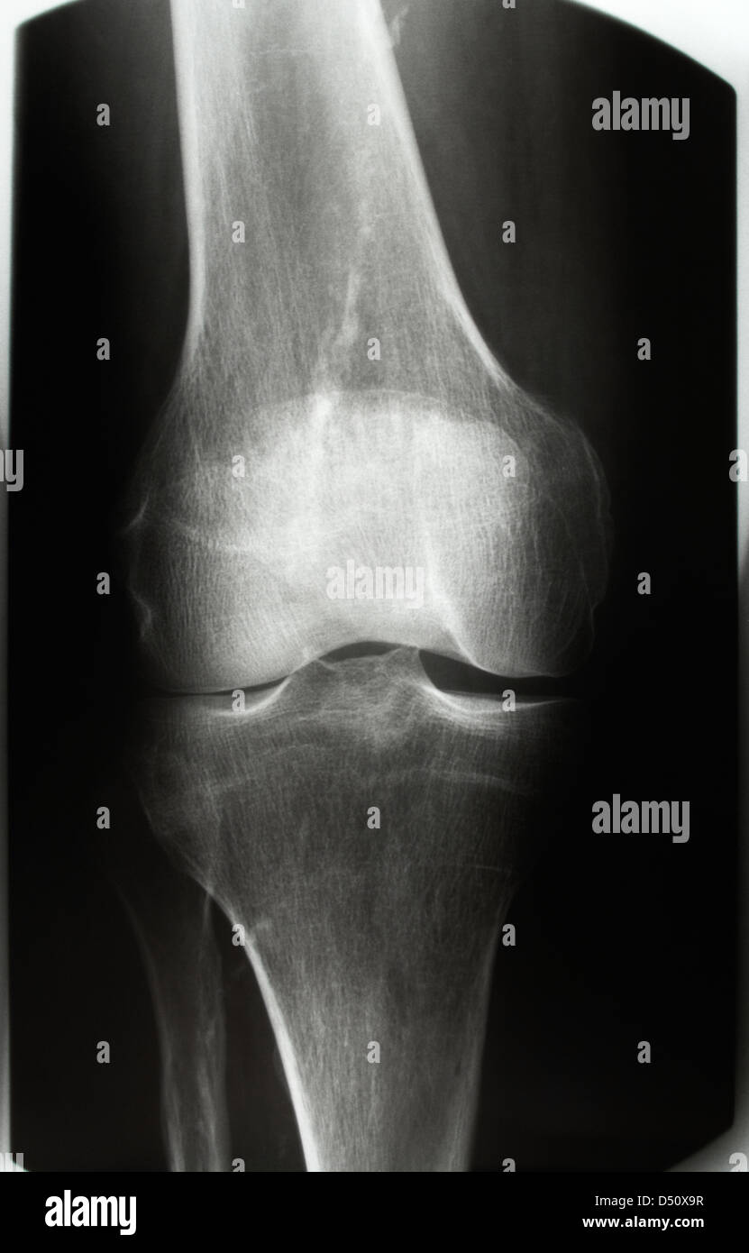 Body frontal anatomy hi-res stock photography and images - Alamy