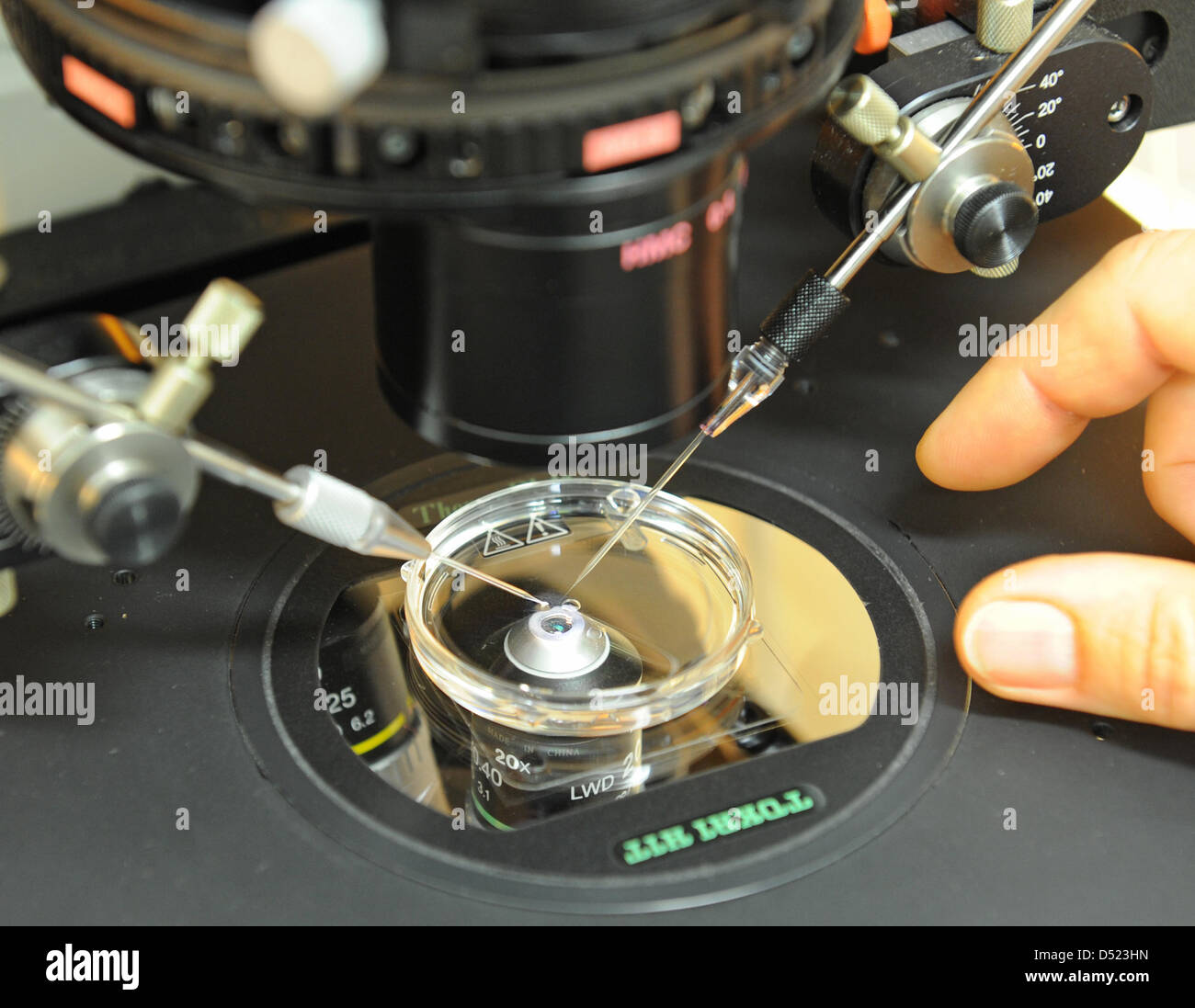 A laboratory engineer injects sperms into an egg cell, which had been ...