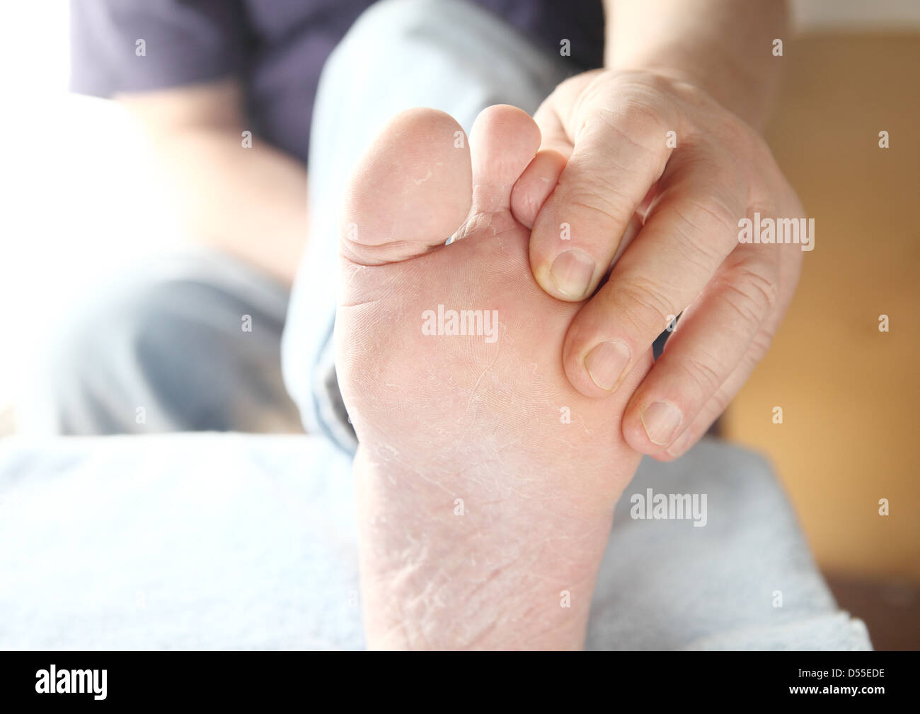 man checks the skin condition on his foot Stock Photo - Alamy