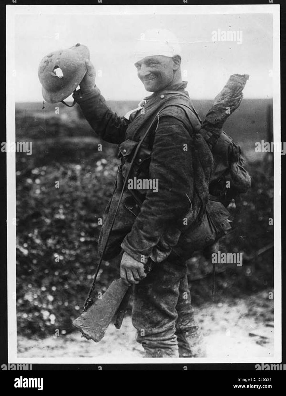 A soldier is shown who survived a dangerous attack thanks to the ...