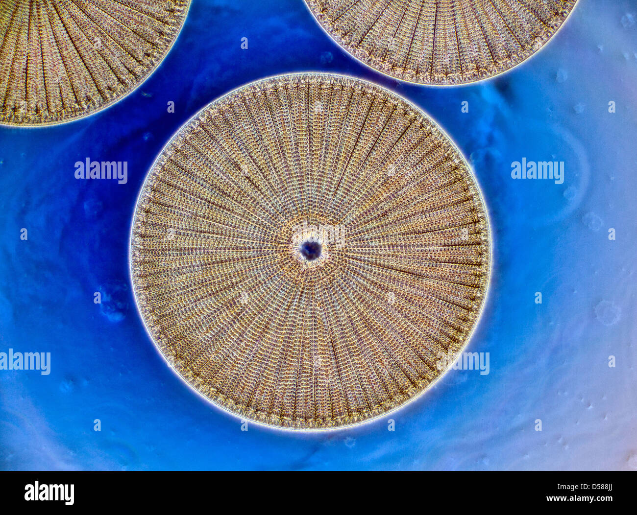 Dark Field Microscopy Diatoms