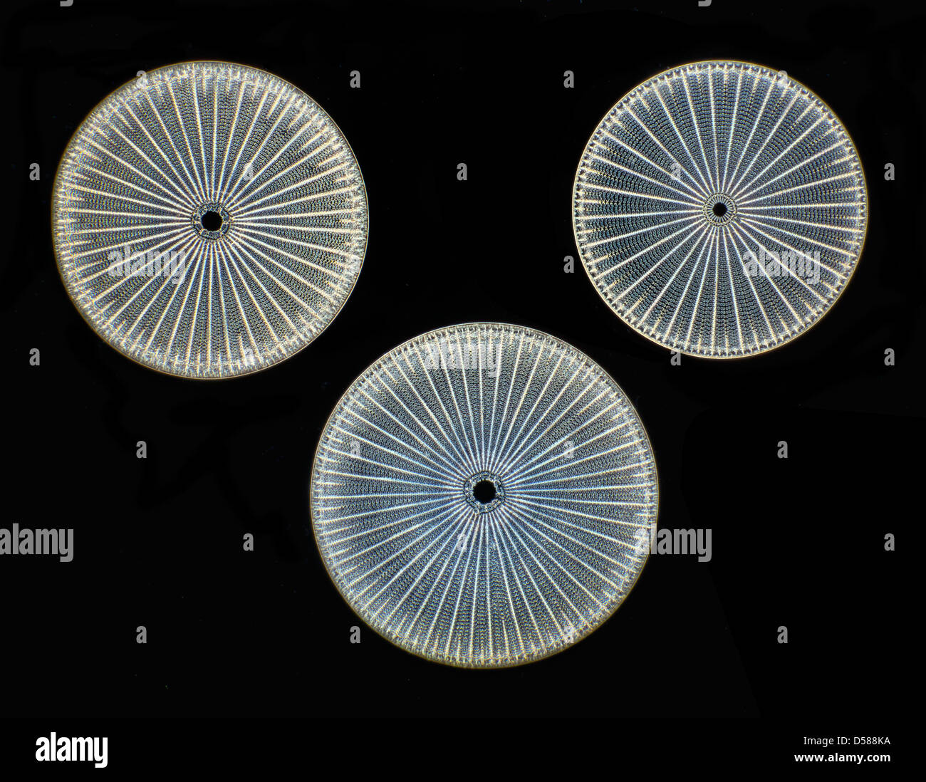 Dark Field Microscopy Diatoms