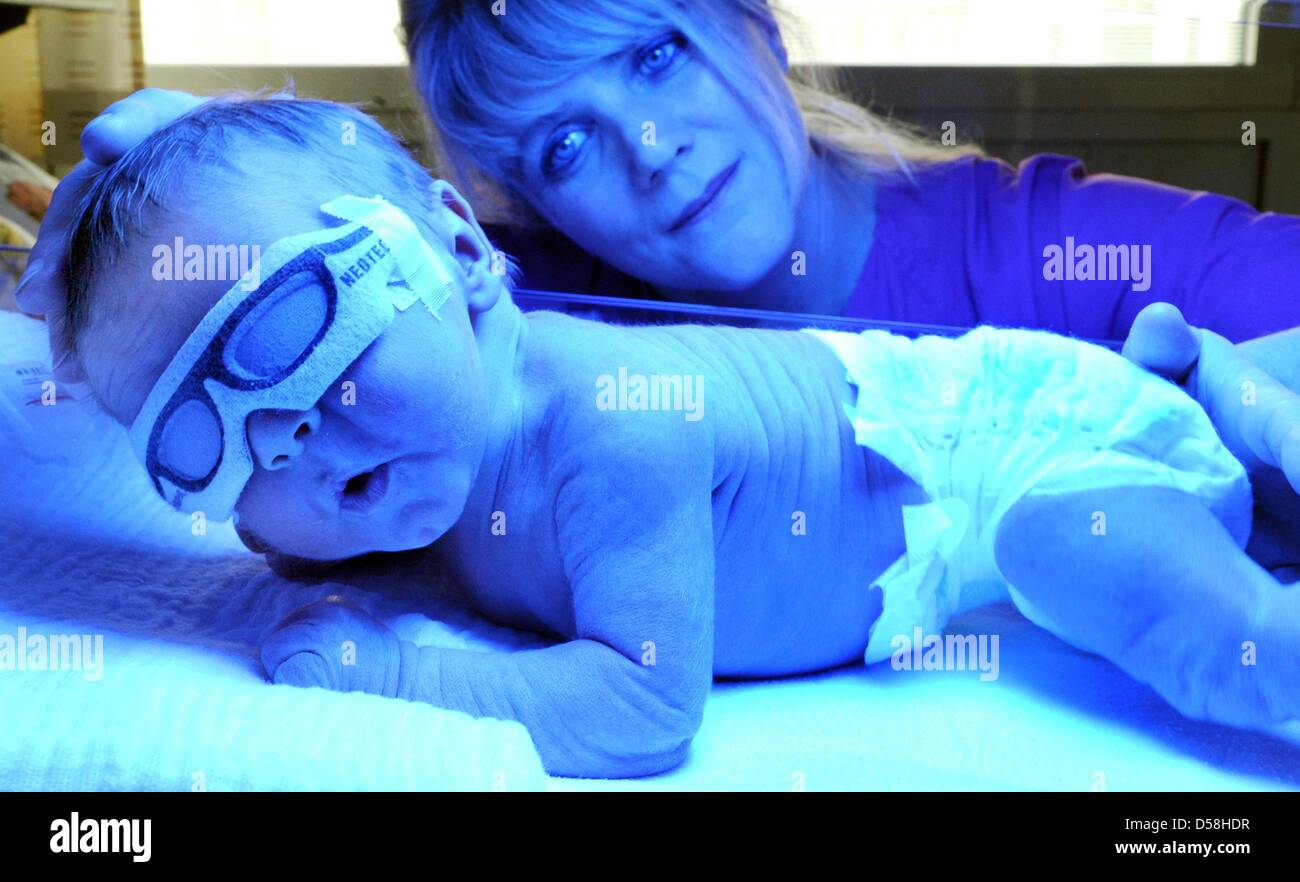 Pediatric nurse Sylvia places a baby in a special bed with warm light ...