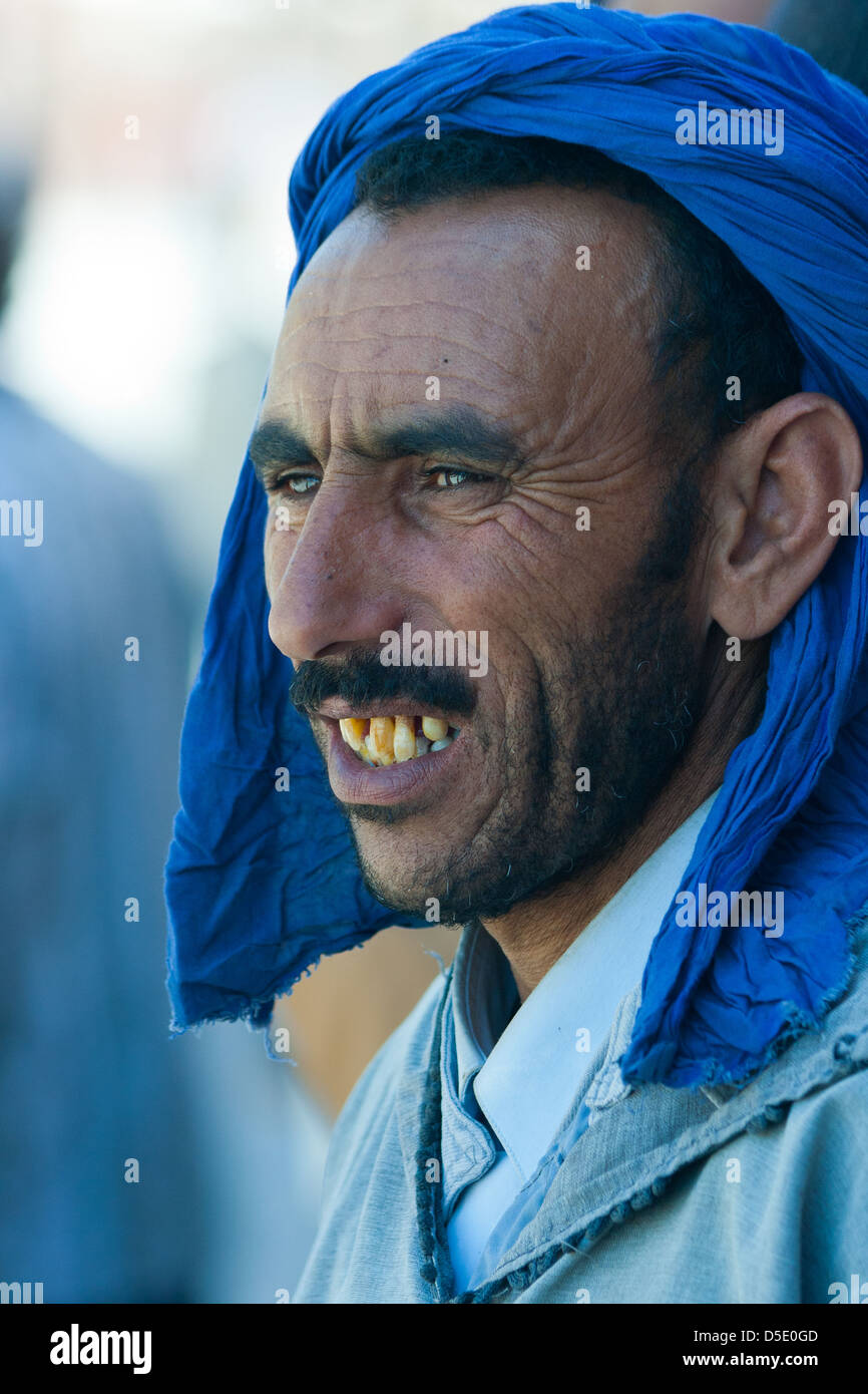 Decayed teeth hi-res stock photography and images - Alamy