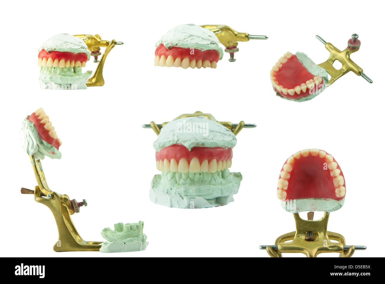 upper dental wax model with jaw set Stock Photo - Alamy