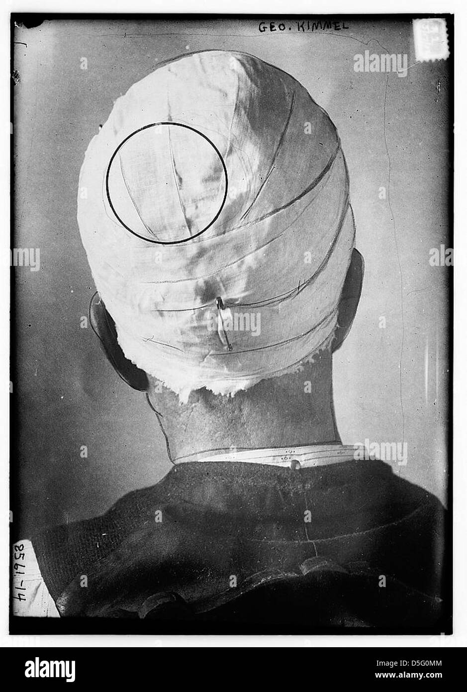 A photograph of George Kimmel, featuring a close-up of the back of his ...