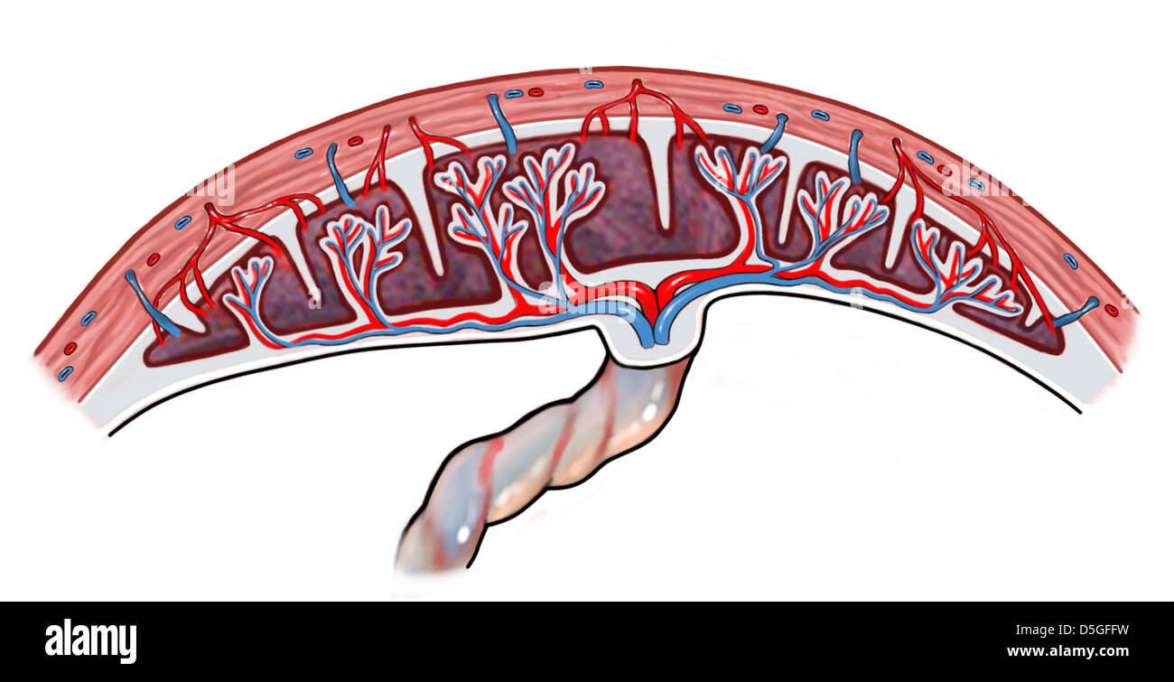 Placenta Under Normal Uterine Contraction and Compression of Vessels ...