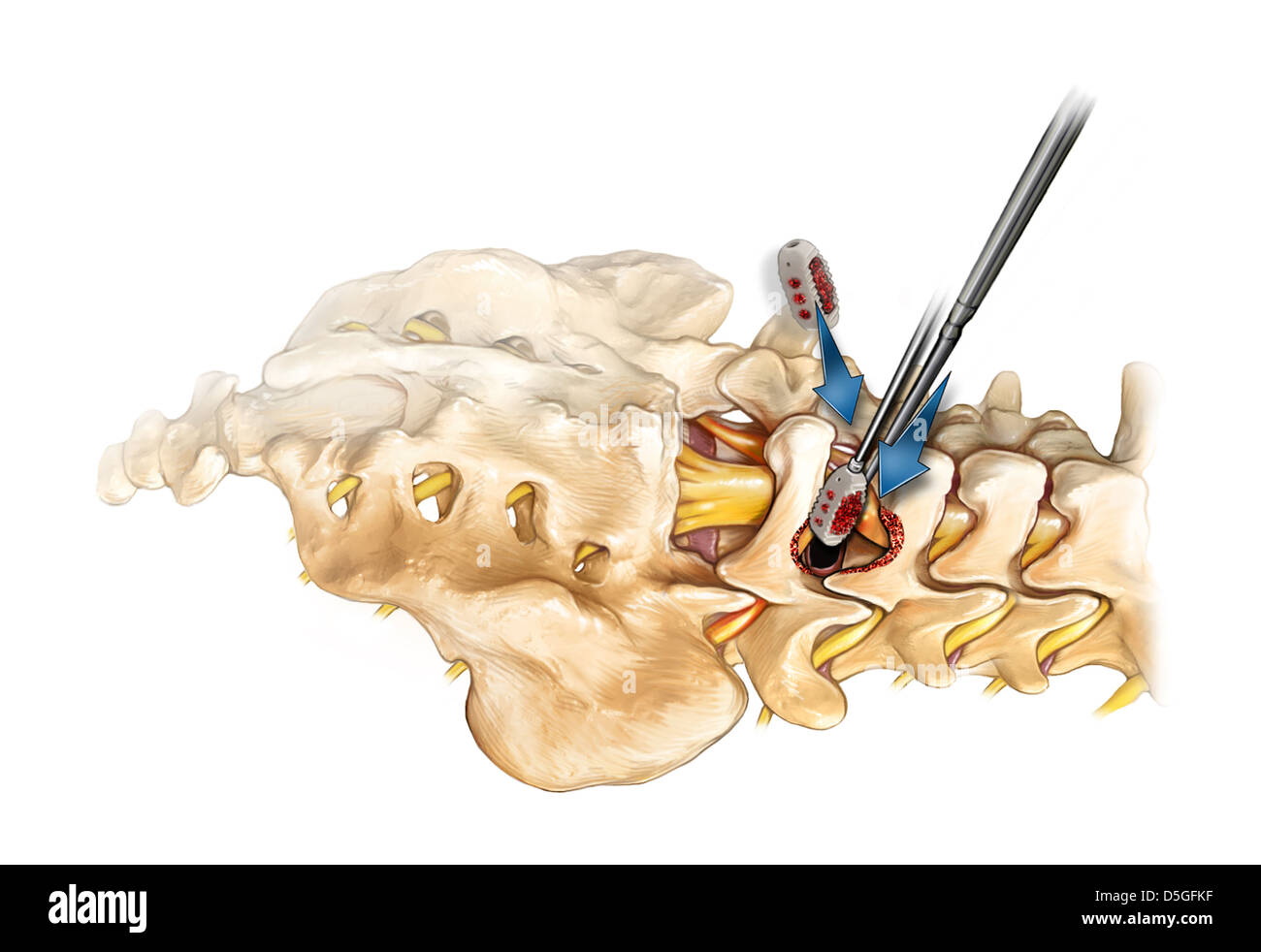 L4 l5 hi-res stock photography and images - Alamy