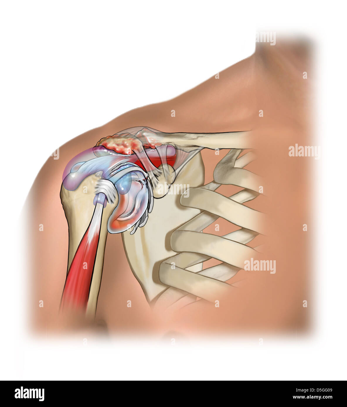 Osteophytes hi-res stock photography and images - Alamy