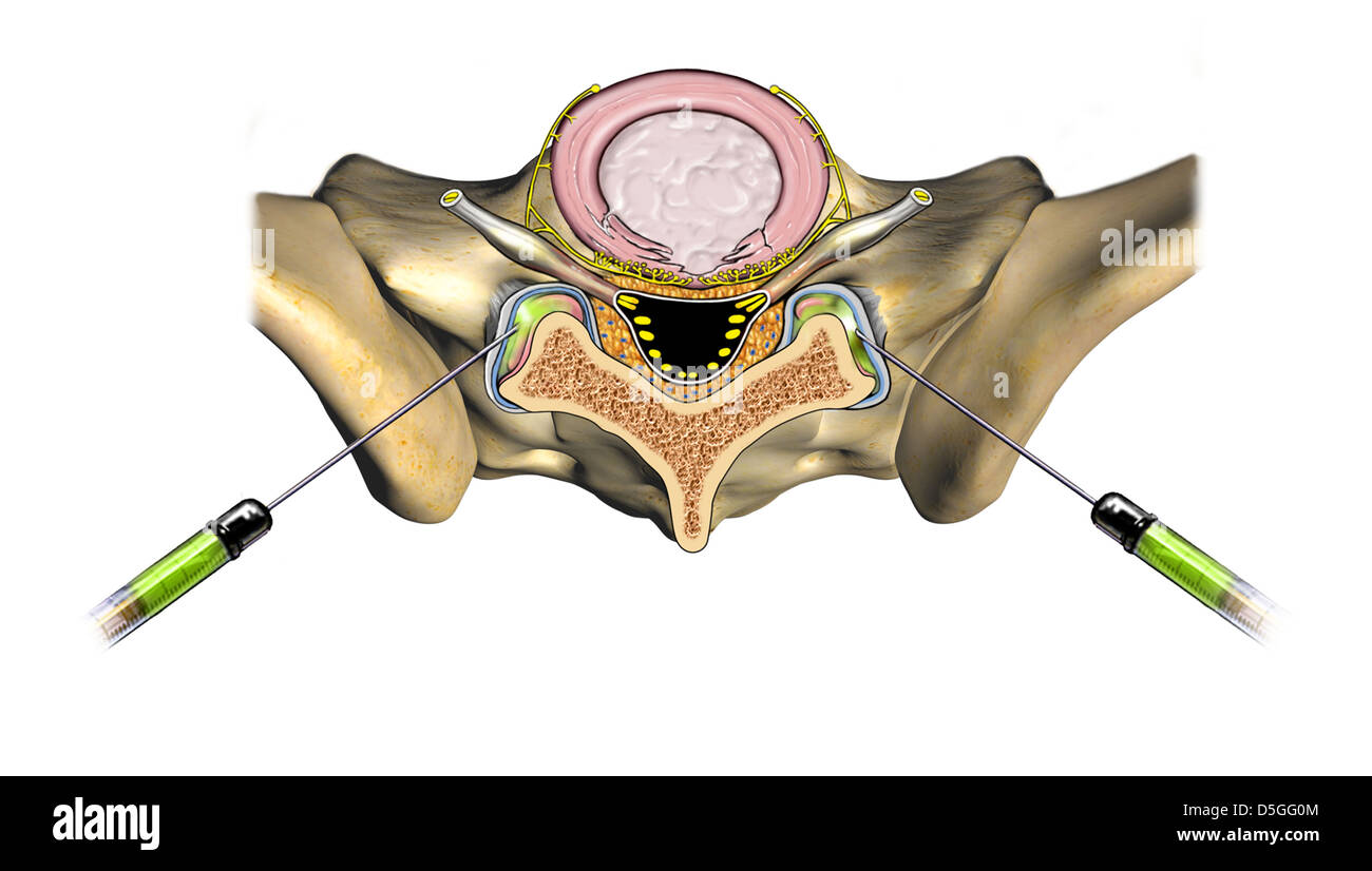 Facet Joints High Resolution Stock Photography and Images - Alamy