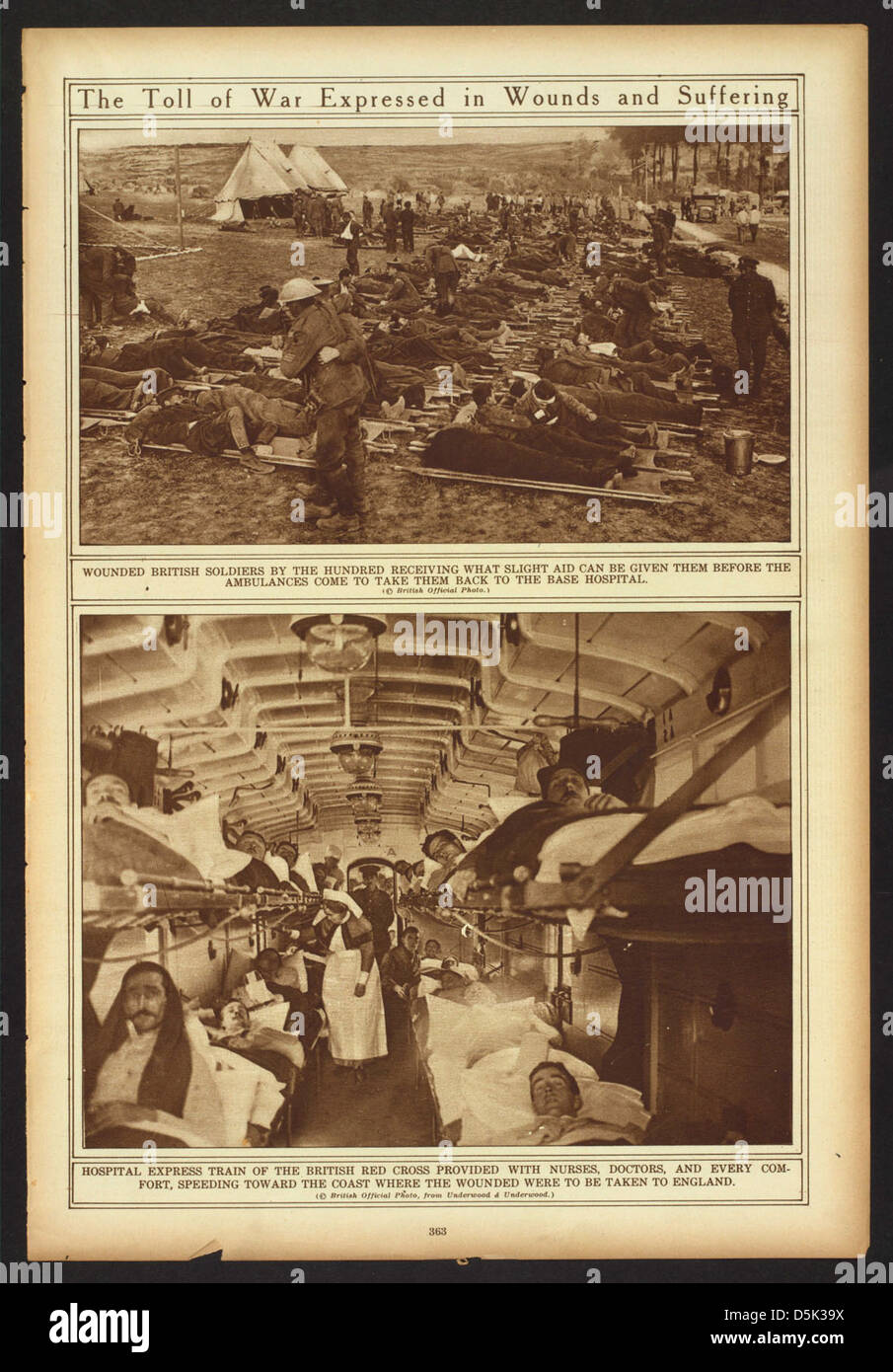 World war 1 wounds hi-res stock photography and images - Alamy