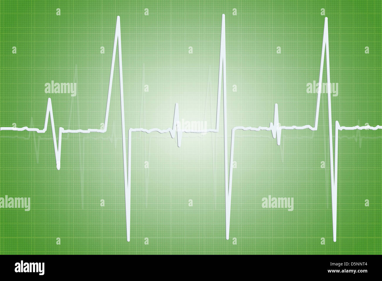 Electrocardiogram - illustration of human heart activity on green ...