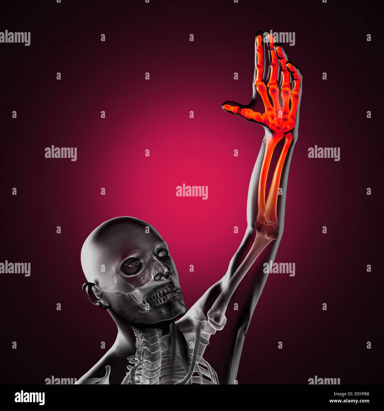 Human radiography hi-res stock photography and images - Alamy