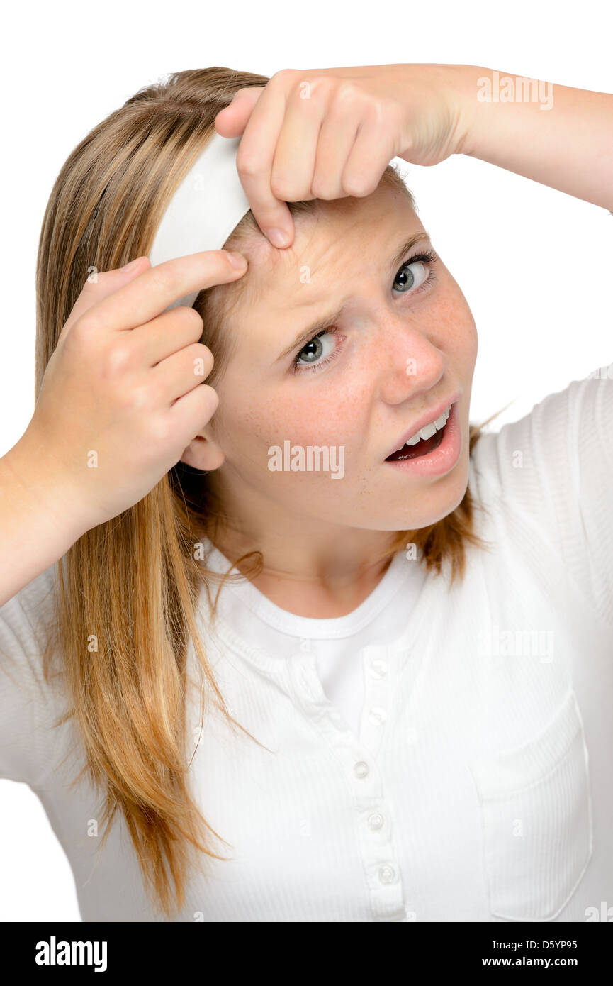 Teenager girl squeezing pimple skin problems spot cleaning face Stock ...