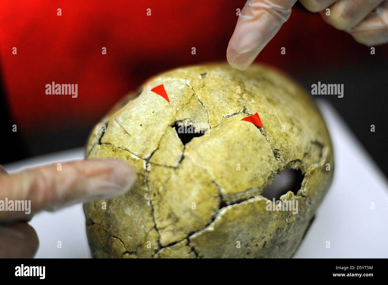 A skull from Warburg with operation marks is presented at the museum of ...
