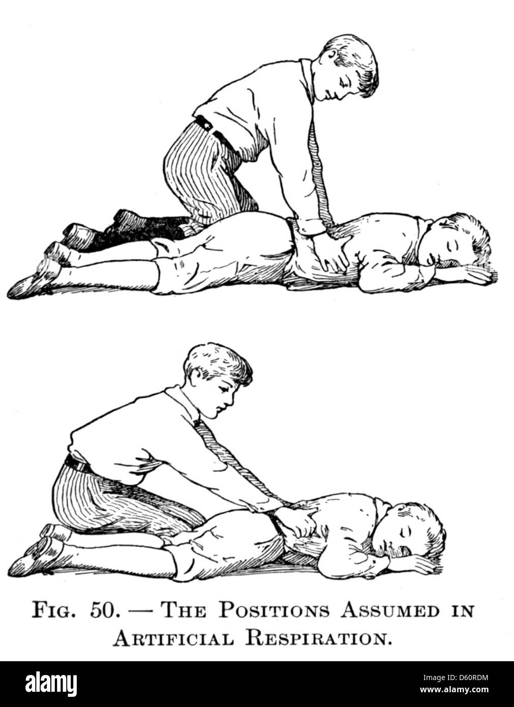 Artificial respiration illustration Black and White Stock Photos ...