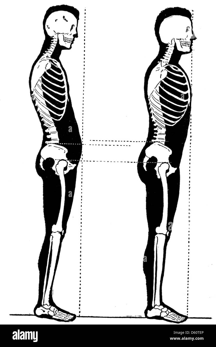 Checkley Black and White Stock Photos & Images - Alamy