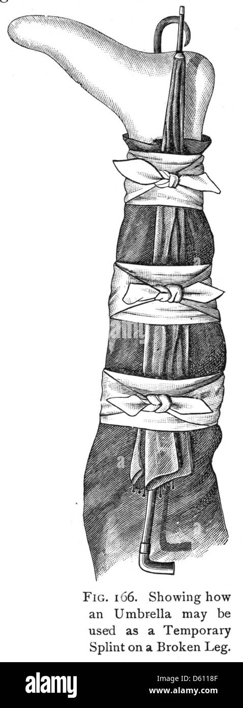 Drawing on splint Black and White Stock Photos & Images - Alamy