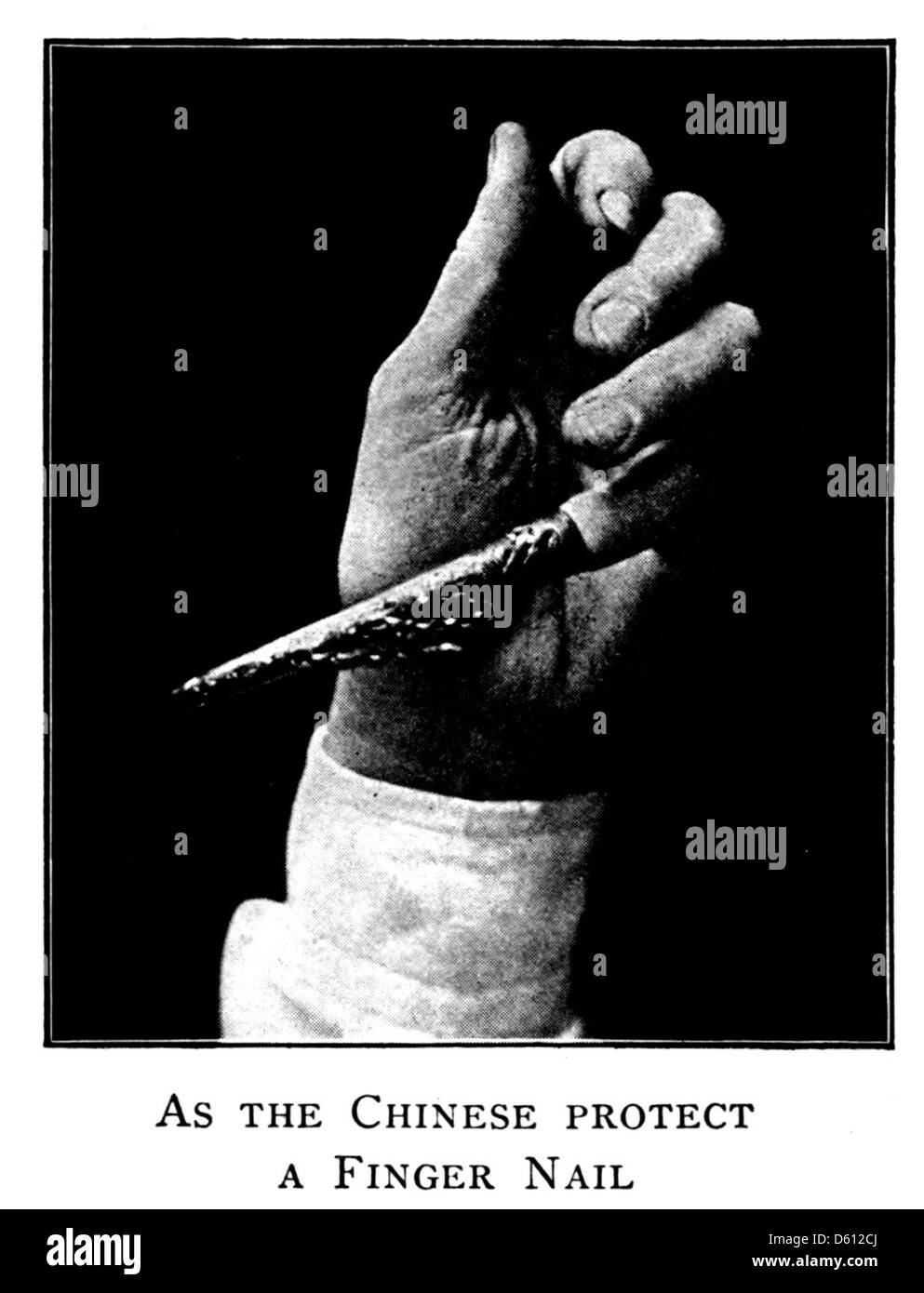 Preventive health care Black and White Stock Photos & Images - Alamy