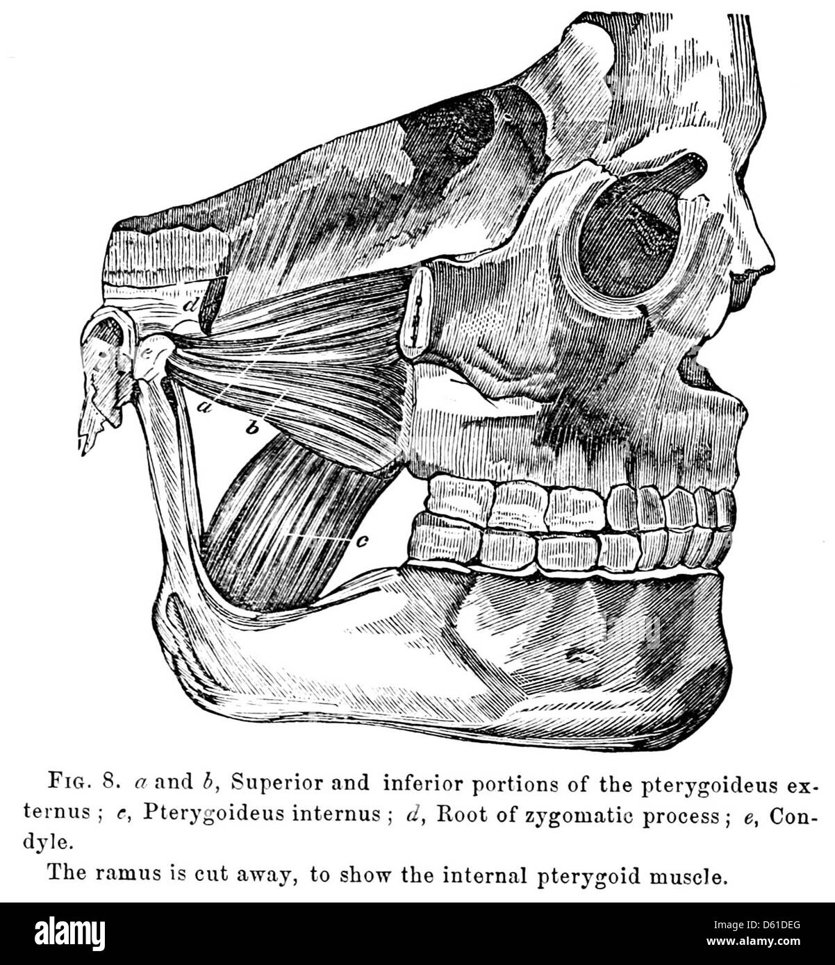 An illustration from a 1868 manual on extracting teeth, showing the ...