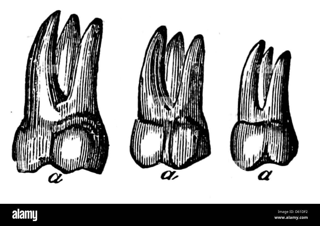 An 1868 manual on the extraction of human teeth, providing a guide on ...