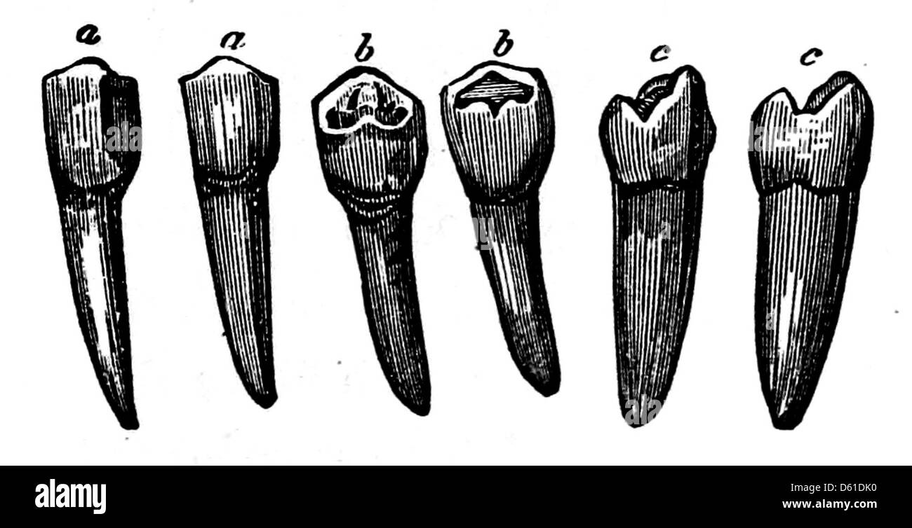 Dental extraction methods Cut Out Stock Images & Pictures - Alamy