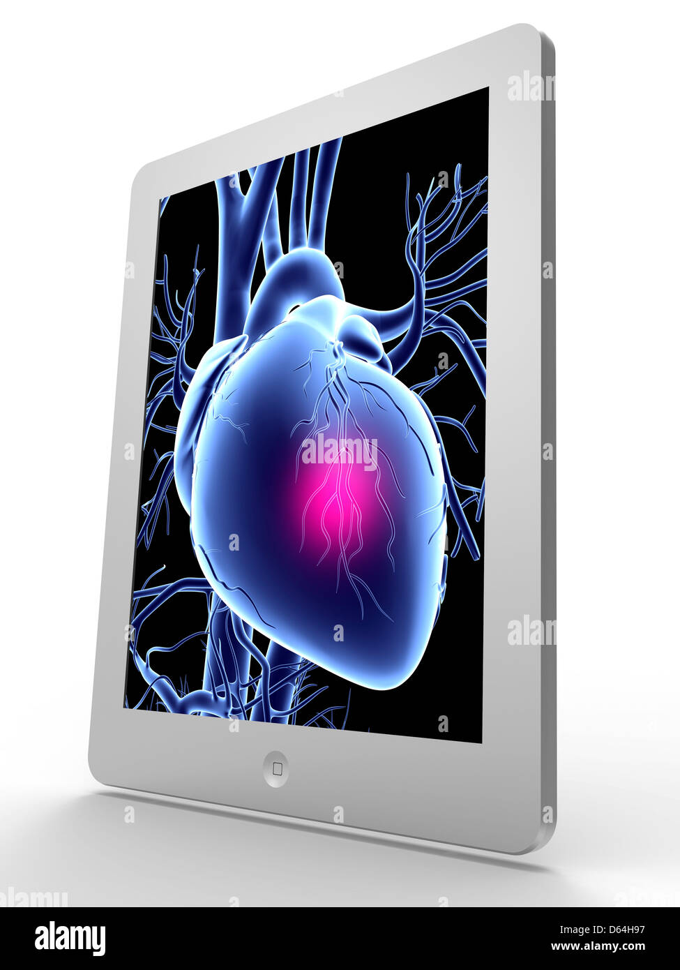 Heart attack equipment hi-res stock photography and images - Alamy