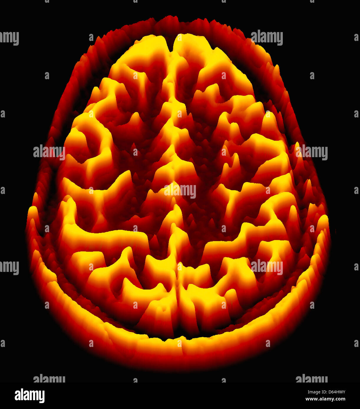 Brain scan, MRI scan, heightmap Stock Photo - Alamy