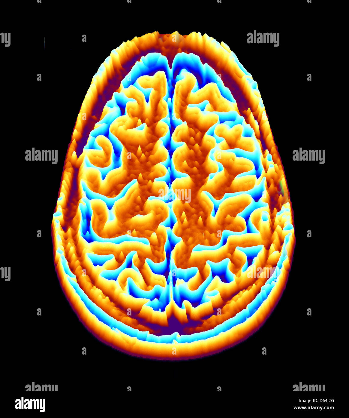 Brain scan, MRI scan, heightmap Stock Photo - Alamy