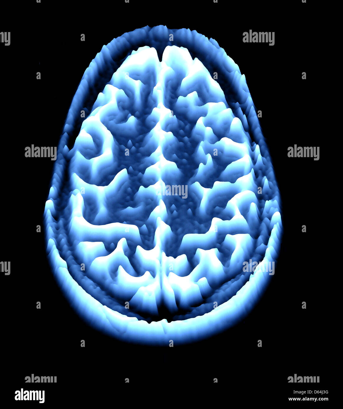 Brain scan, MRI scan, heightmap Stock Photo - Alamy