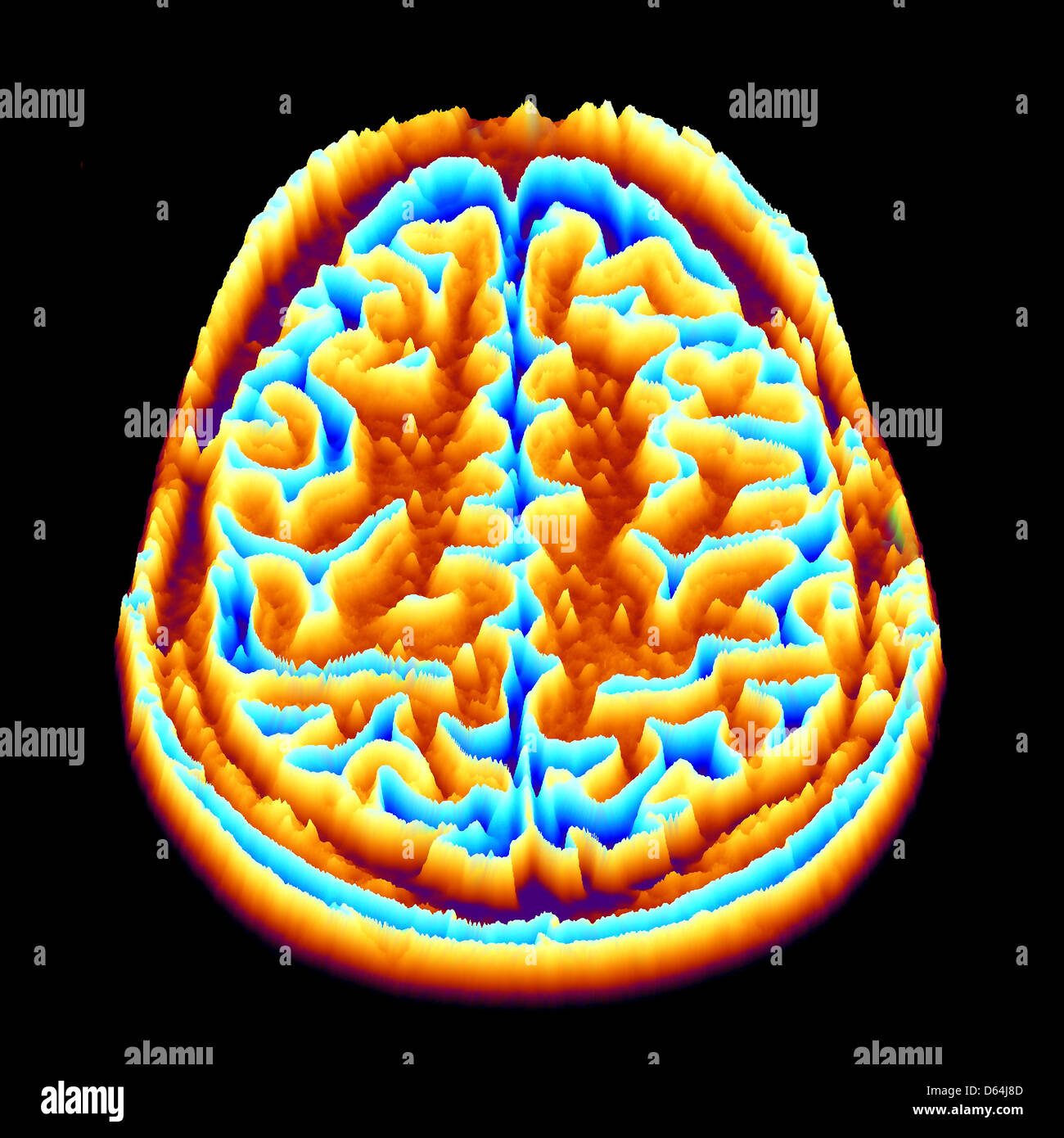 Brain scan, MRI scan, heightmap Stock Photo - Alamy