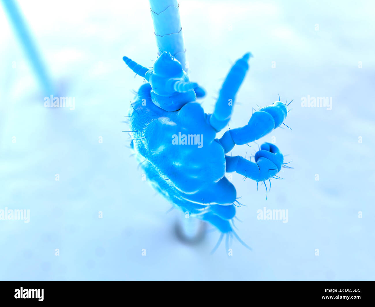 Phthirus hi-res stock photography and images - Alamy